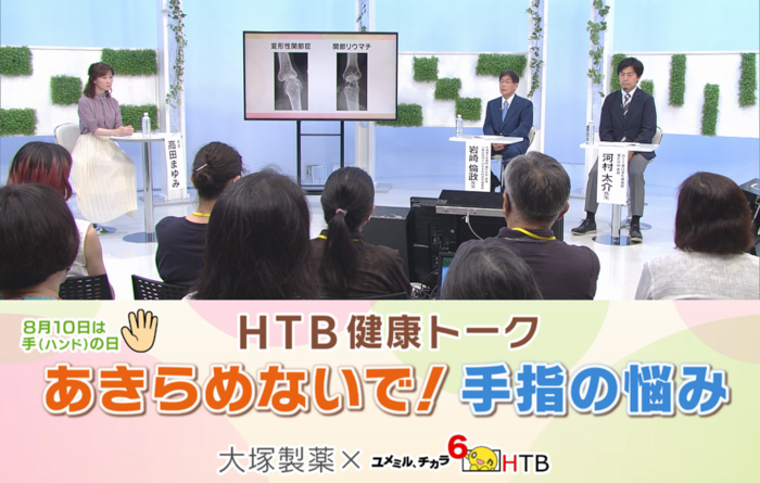 SODANE - 「HTB健康トーク あきらめないで！手指の悩み」トークショーの模様をHTBの番組でも紹介